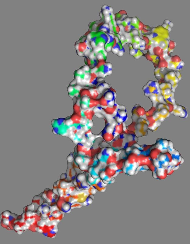Mutation in the NOTCH1 gene influences aggressive course of blood ...